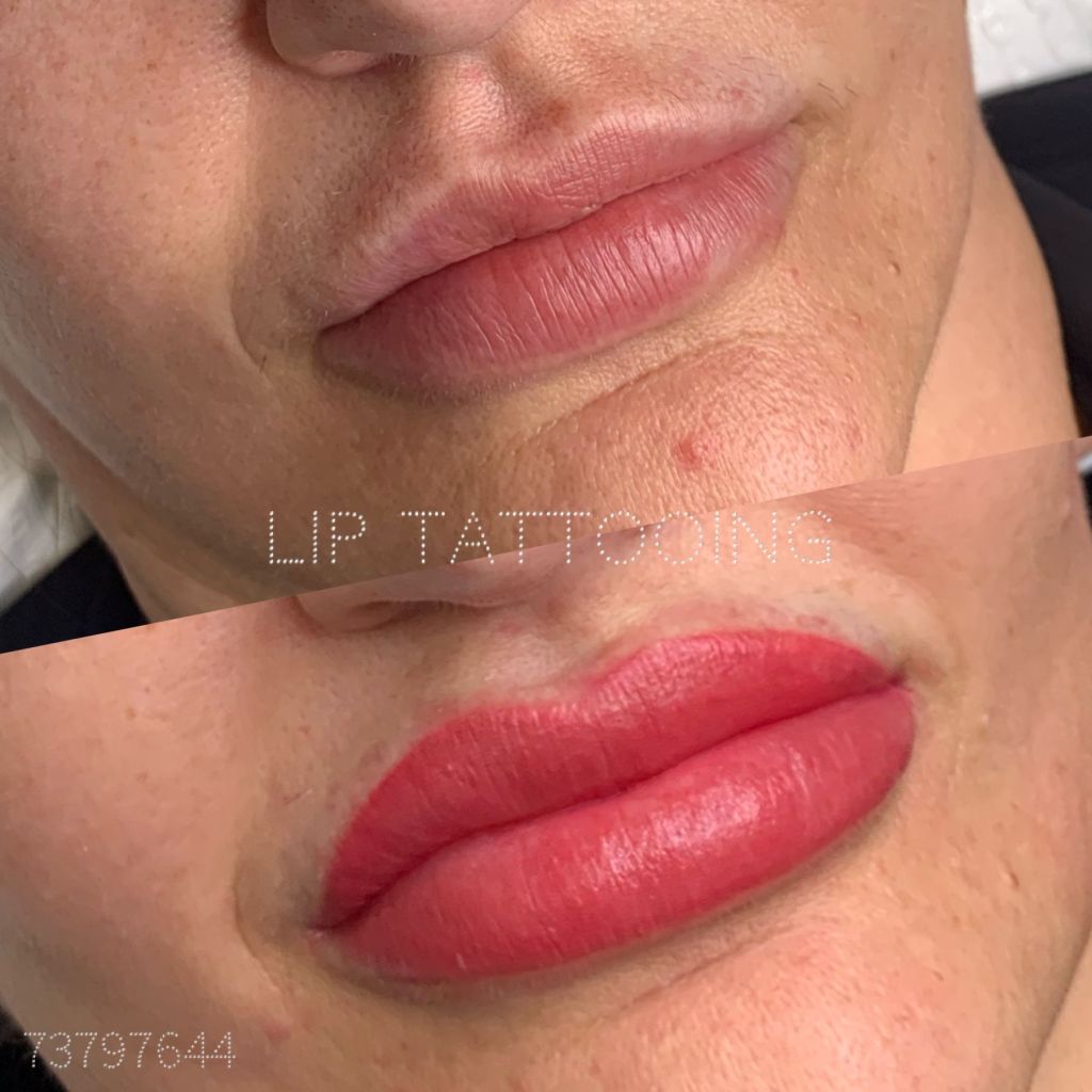 Lip Tattooing / Blushing – Skincare Laser Clinic